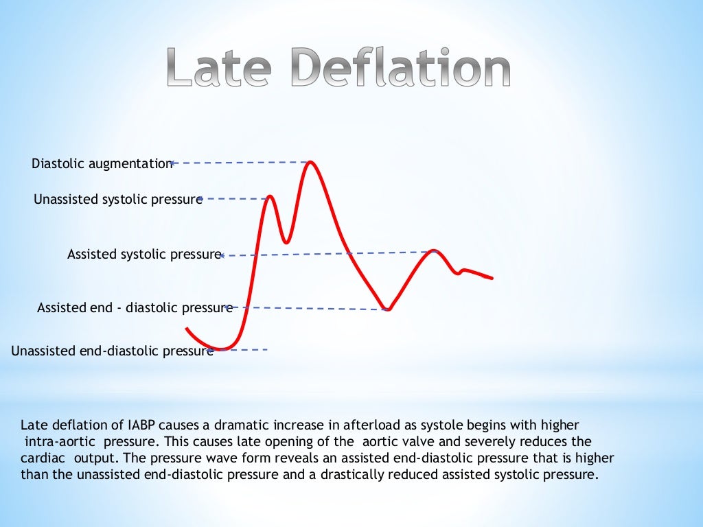 Iabp wave forms