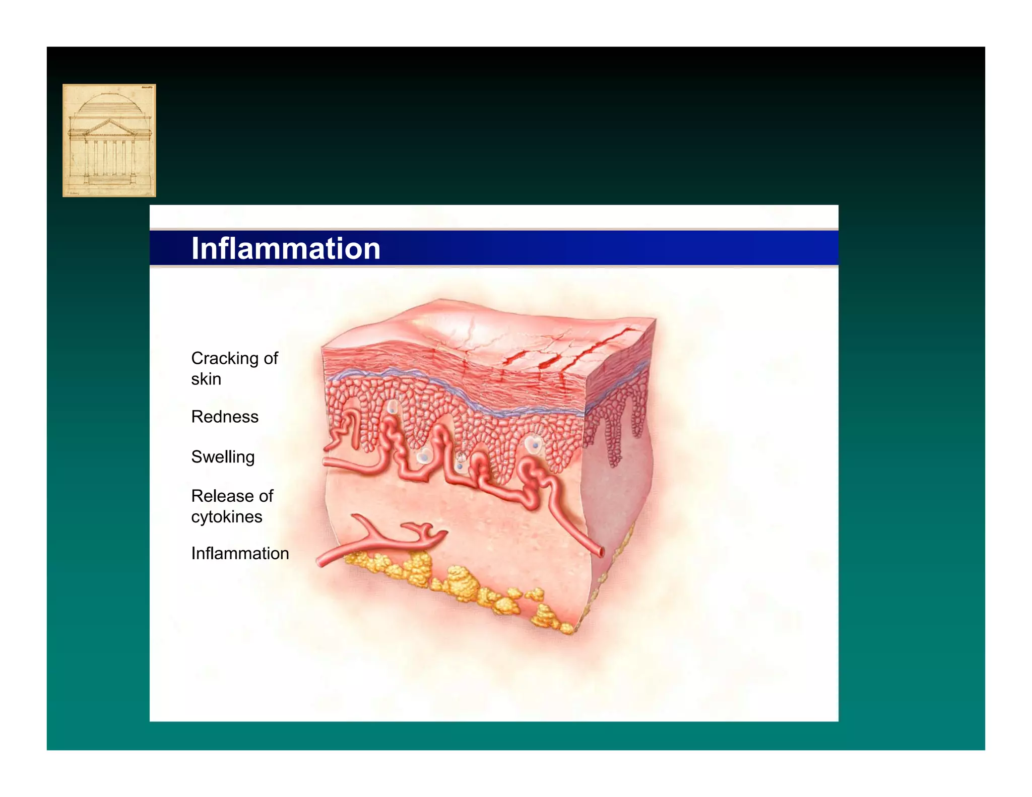 Incontinence Associated Dermatitis by Prof Dr Mikel Gray | PDF