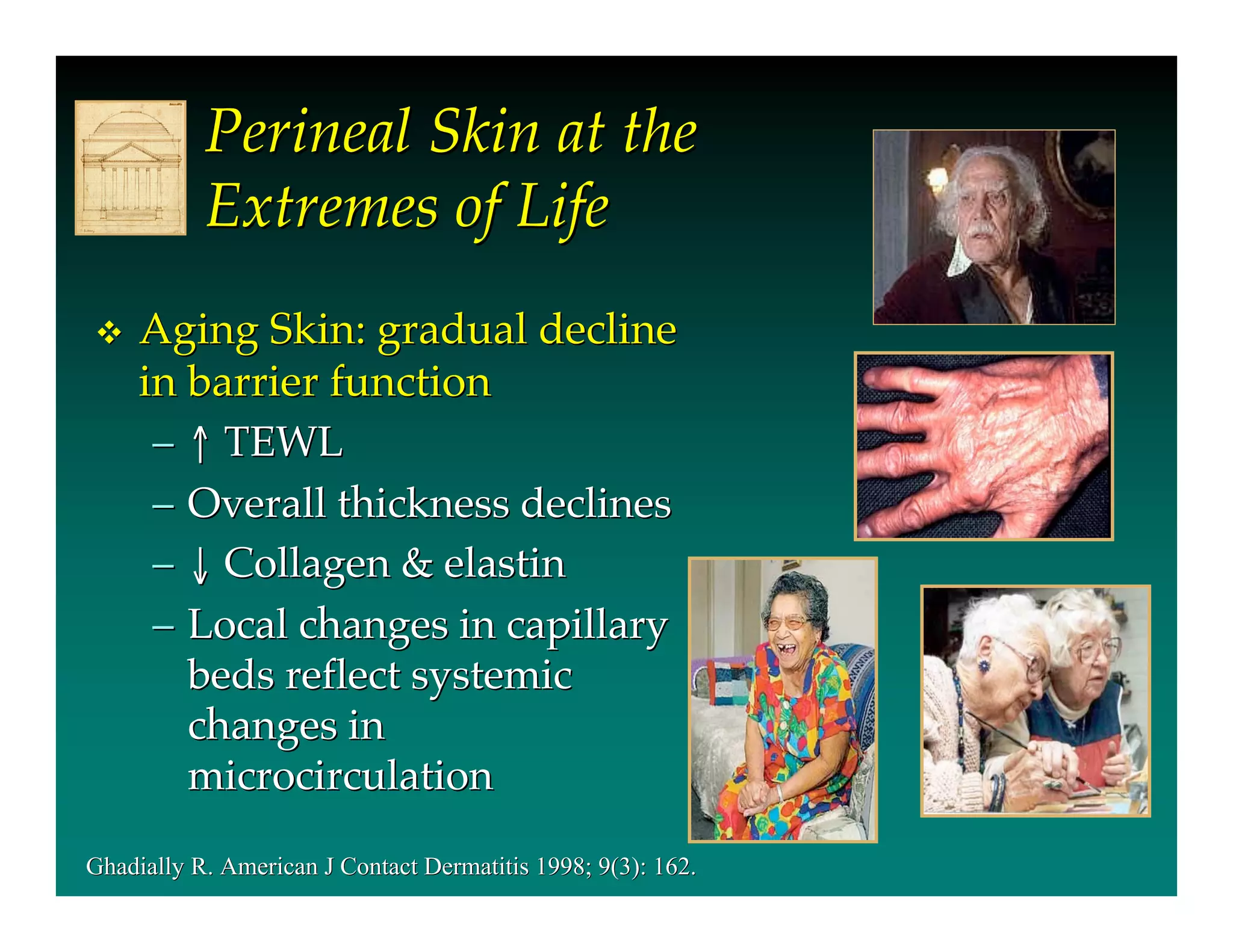 Incontinence Associated Dermatitis by Prof Dr Mikel Gray | PDF