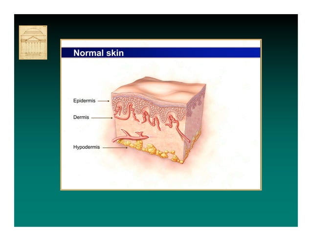 Incontinence Associated Dermatitis by Prof Dr Mikel Gray | PPT