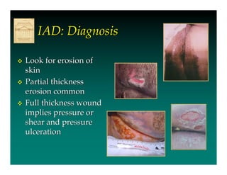 Incontinence Associated Dermatitis by Prof Dr Mikel Gray | PPT