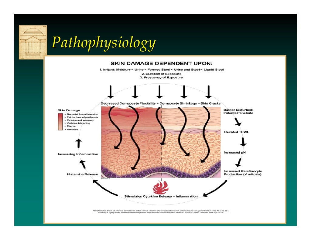 Incontinence Associated Dermatitis by Prof Dr Mikel Gray