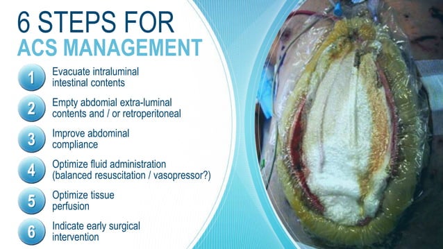 Intra-abdominal Hypertension - Abdominal Compartment Syndrome part 2 | PPT