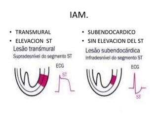 Infarto agudo de miocardio | PPTX