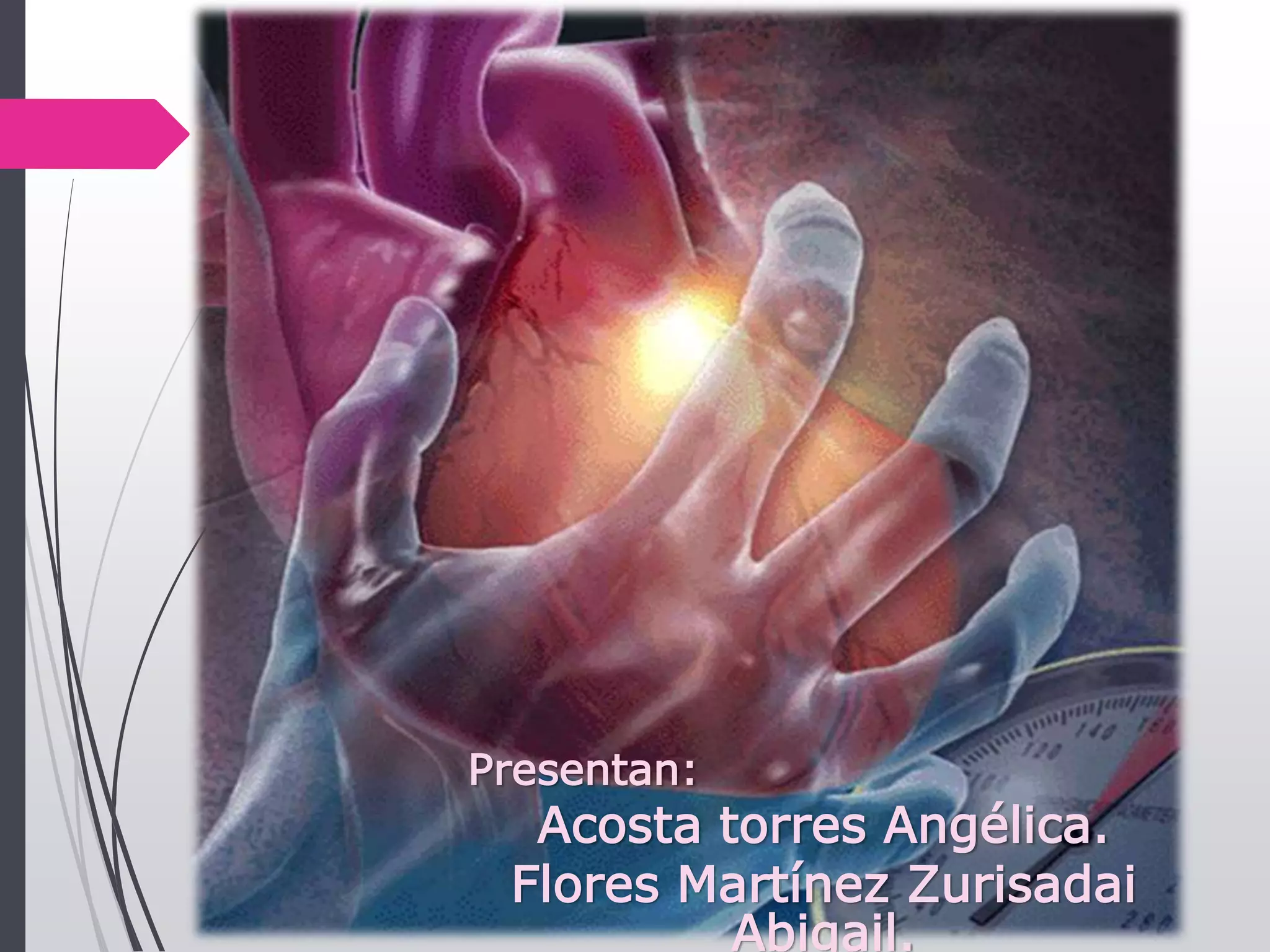 Infarto Agudo al Miocardio. | PPTX