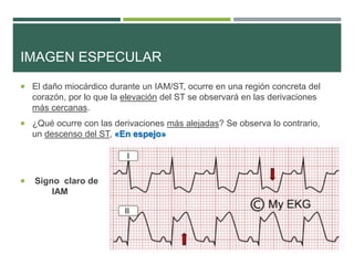 Electrocardiograma Básico Conceptos Básicos Pdf