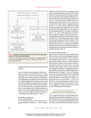 Iam ecg nejm | PDF