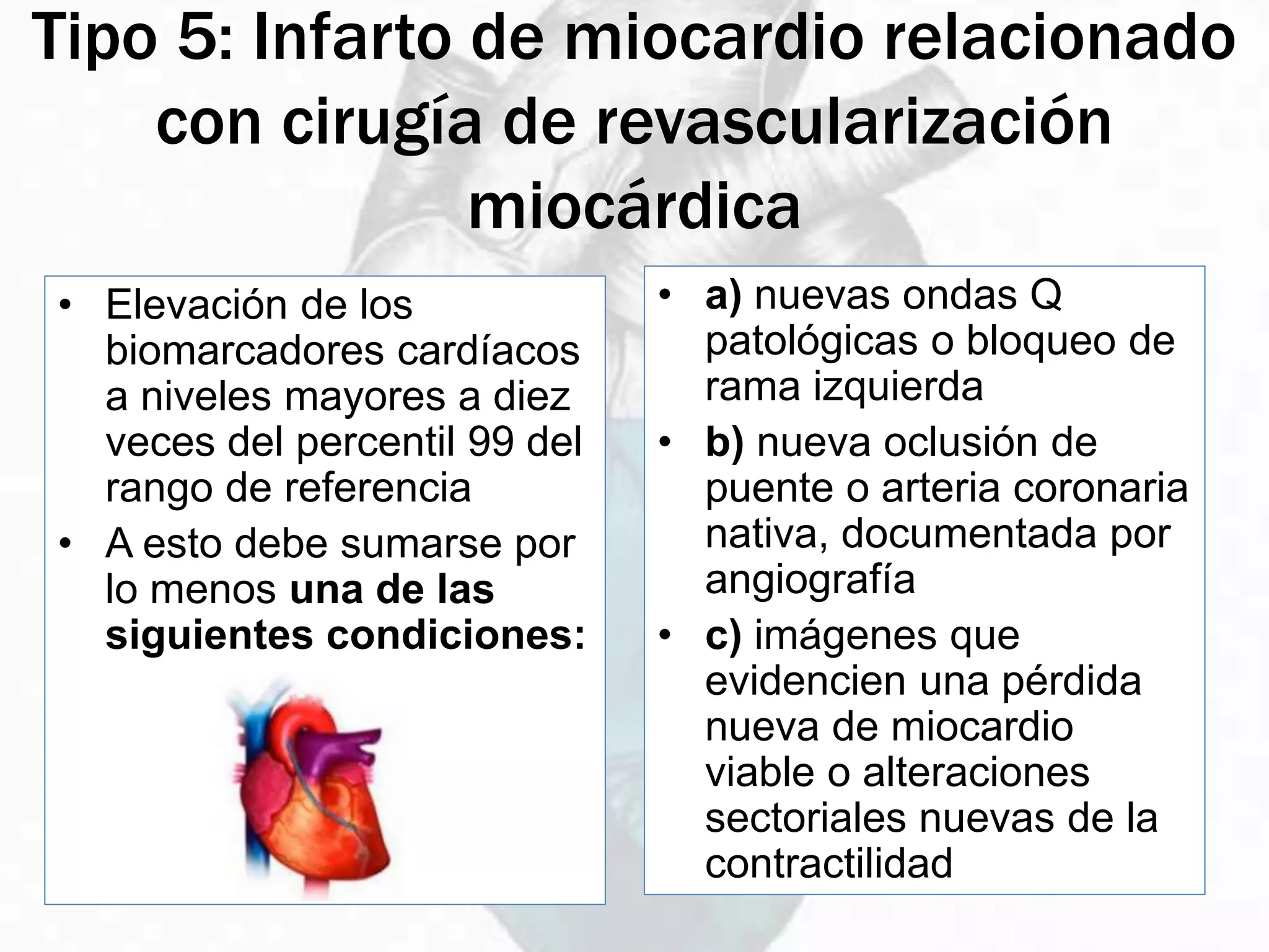 Infarto Agudo Al Miocardio | PPTX