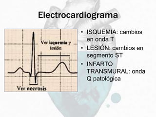 Infarto Agudo Al Miocardio | PPTX