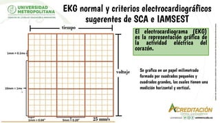 Síndrome coronario agudo sin elevación del segmento ST | PDF