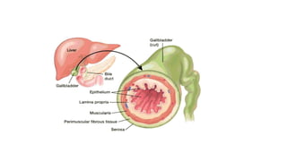 Carcinoma Gall Bladder- A histological surprise | PPTX