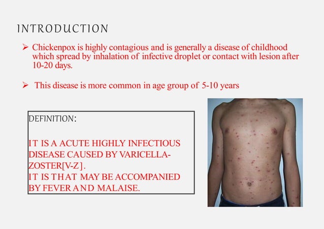 Chickenpox Department of Physiotherapy, SHUATS, Prayagraj | PPTX