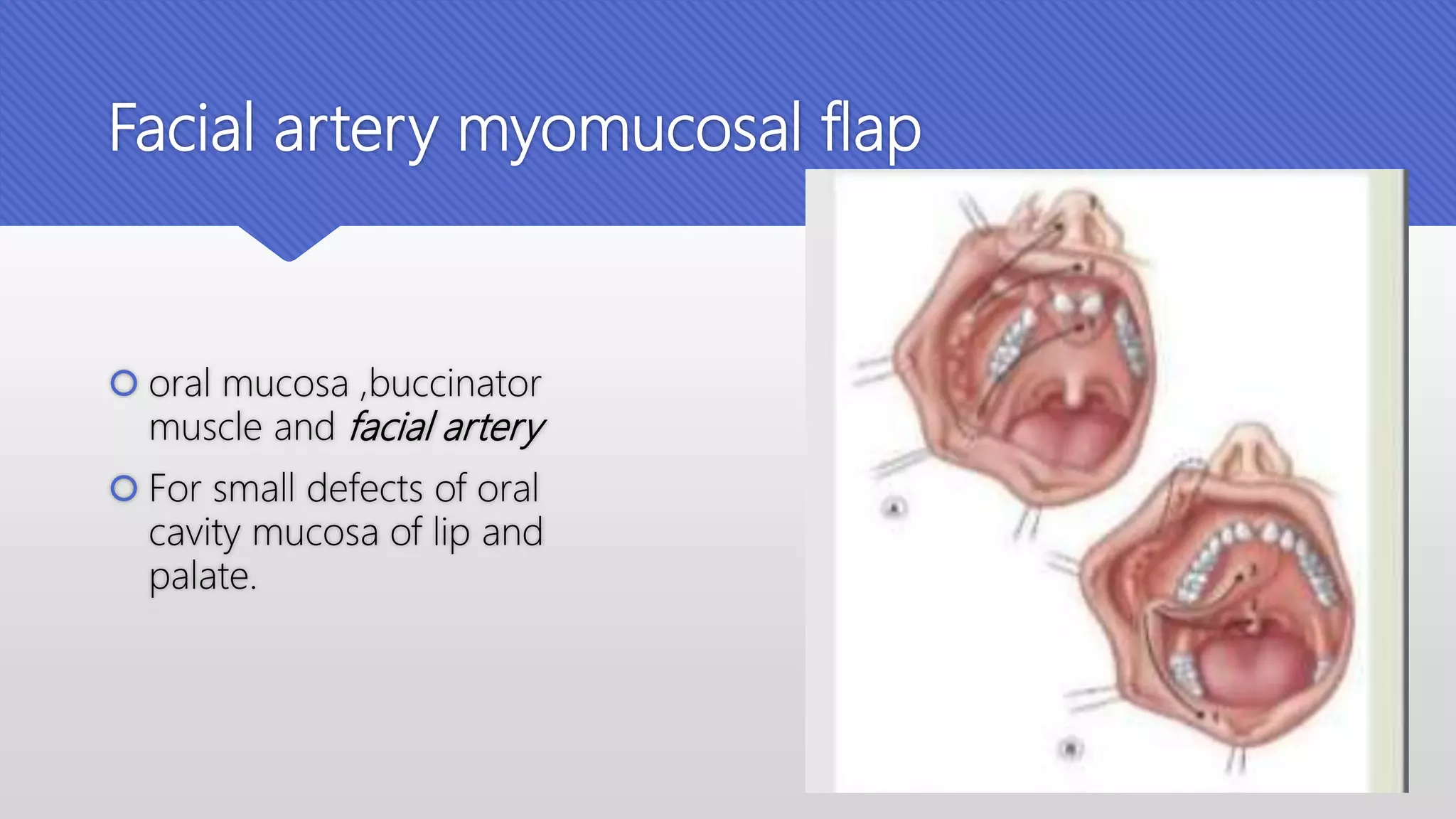Grafts and flaps in head and neck | PPTX