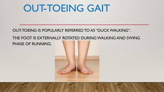 I am sharing 'OUT-TOEING GAIT' with you.pptx
