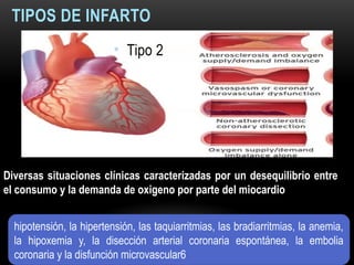 infarto agudo del miocardio sin elevacion del st in st.pptx