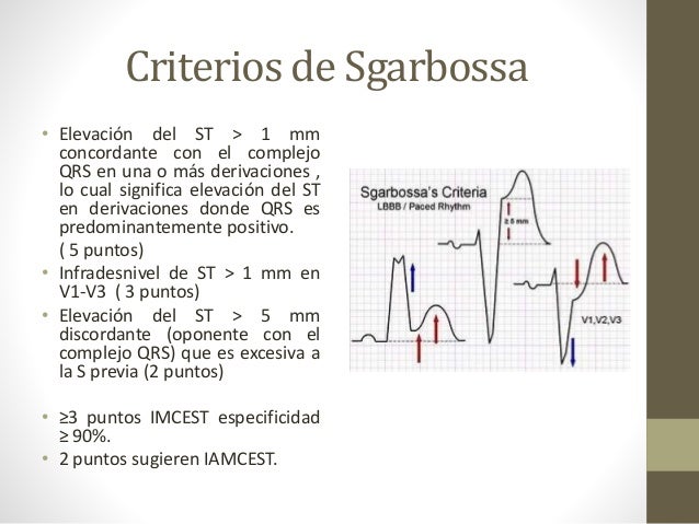 Infarto agudo al miocardio con elevacion del segmento ST