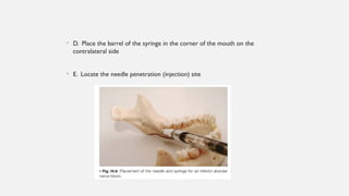 Inferior alveolar nerve block in dentistry | PPTX