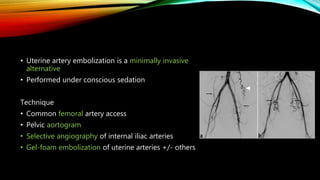 Interventional Radiology and Hysterectomy in PPH | PPT