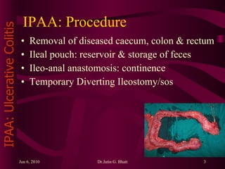 IAPP By Department of Surgery PDU Medical College | PPT | Digestive ...