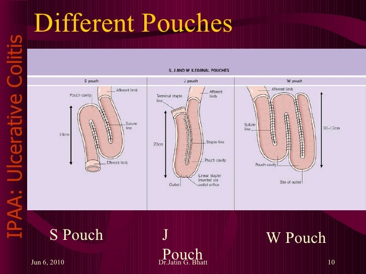 IAPP By Department of Surgery PDU Medical College