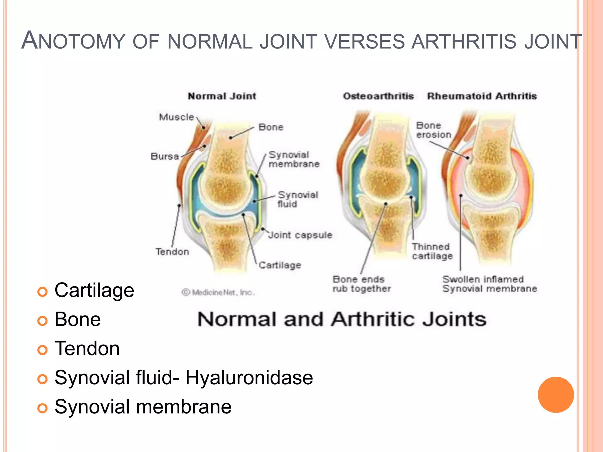 Intra articular drug delivery system final | PPTX