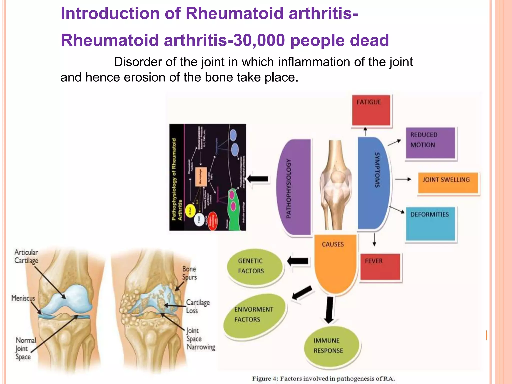 Intra articular drug delivery system final | PPTX