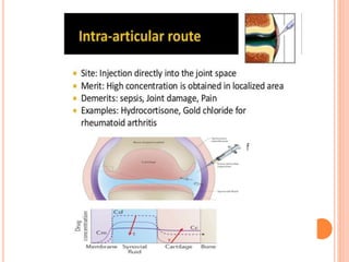 Intra articular drug delivery system final | PPTX