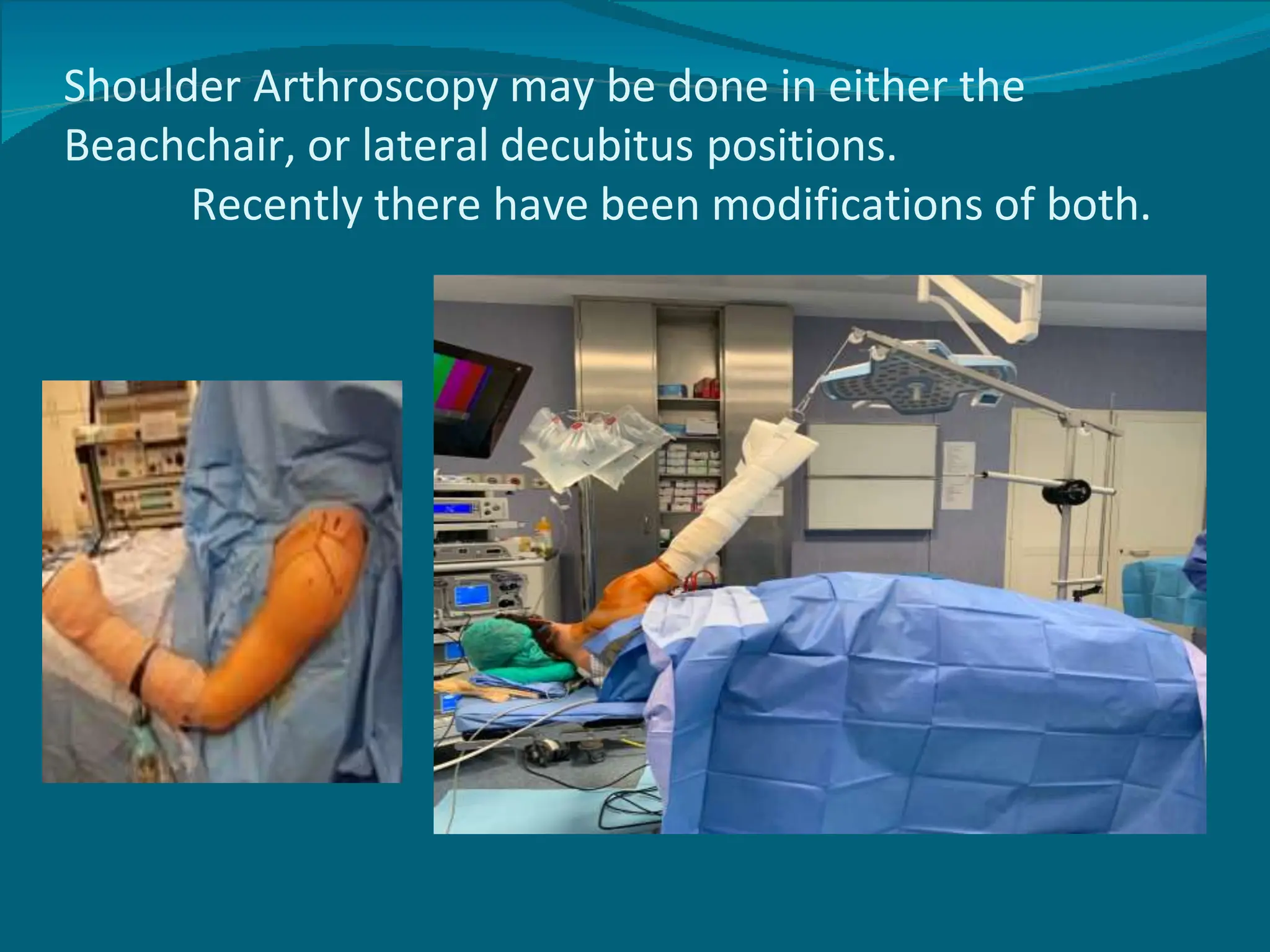 Shoulder Arthroscopy positioning and preparation | PPTX