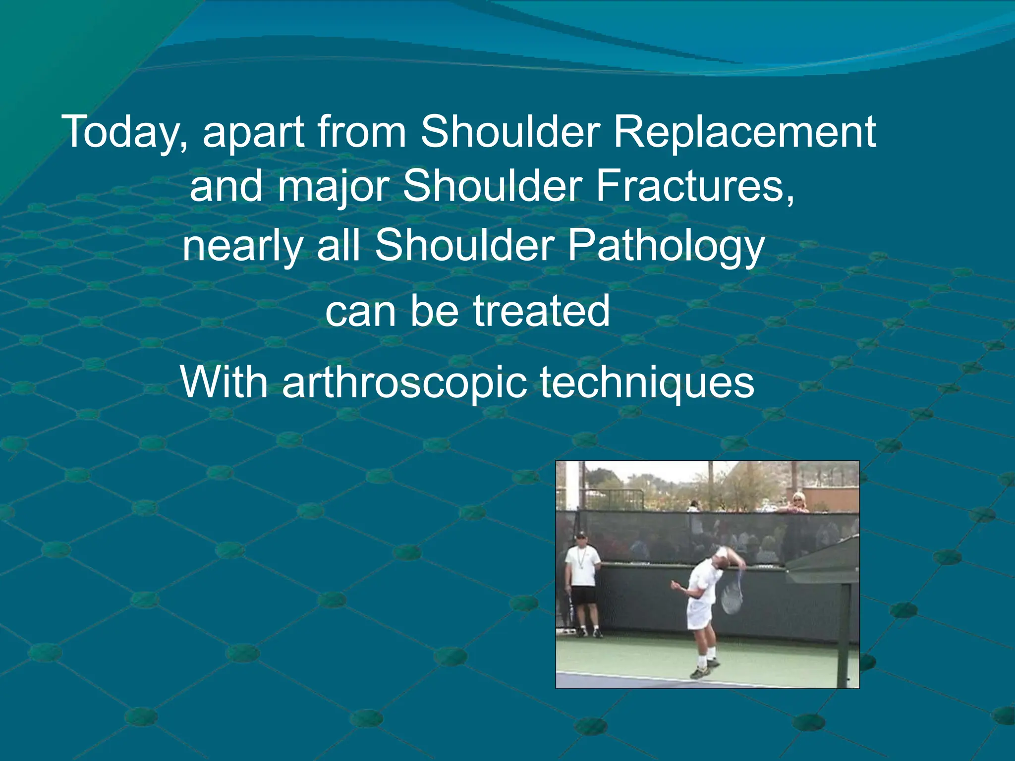 Shoulder Arthroscopy positioning and preparation | PPTX