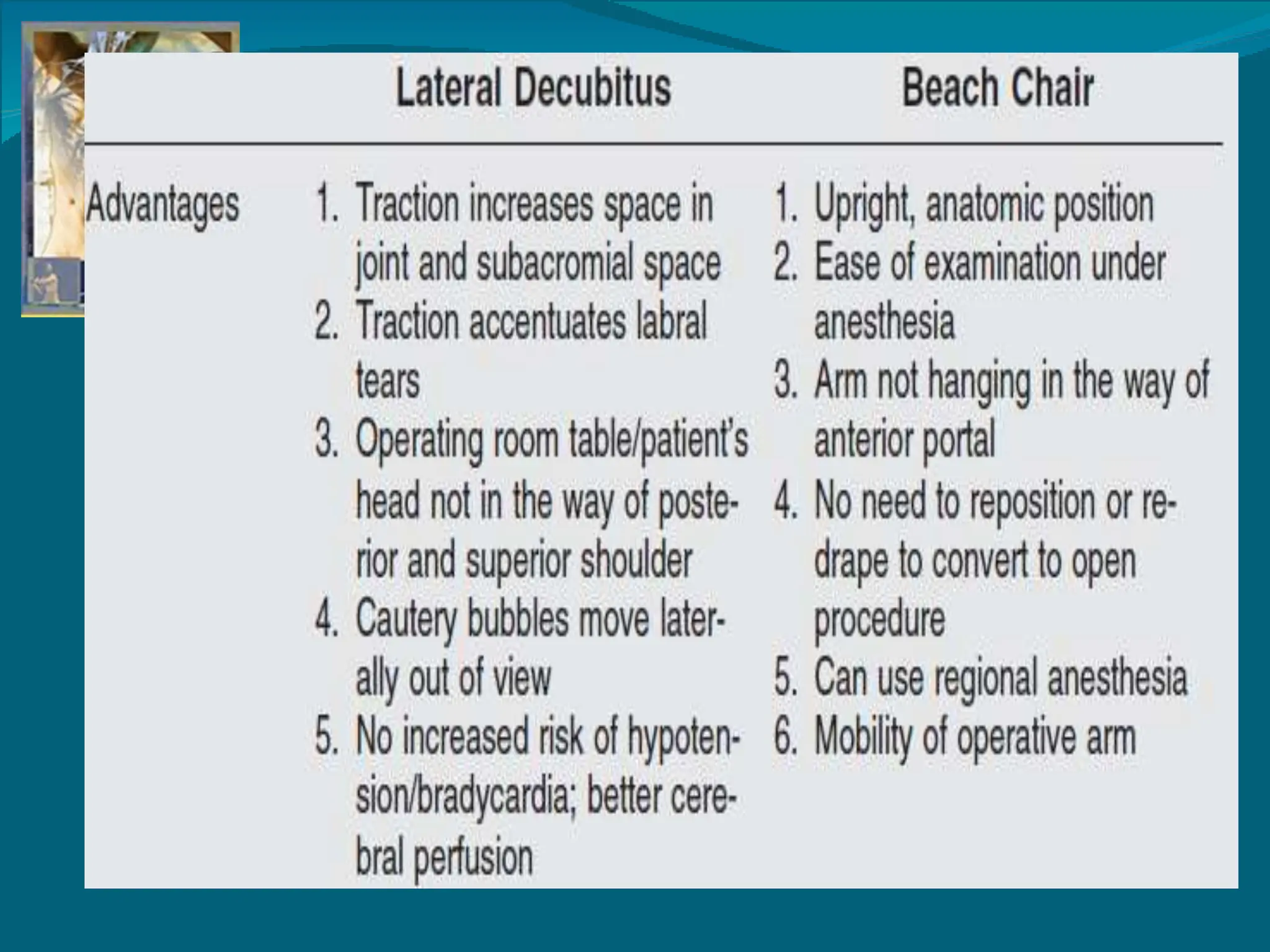 Shoulder Arthroscopy positioning and preparation | PPTX
