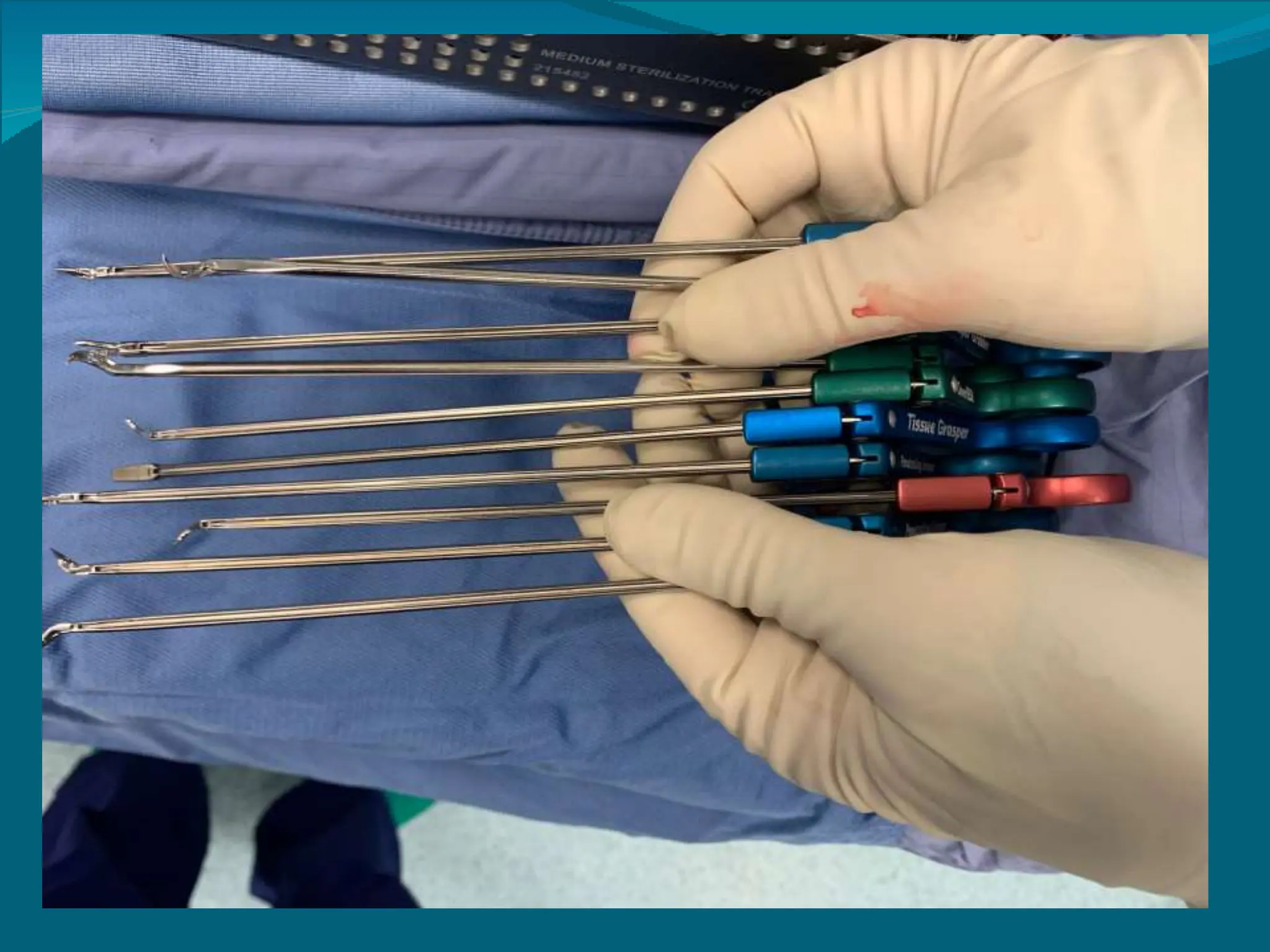 Shoulder Arthroscopy positioning and preparation | PPTX