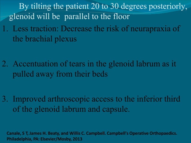 Shoulder Arthroscopy positioning and preparation | PPTX