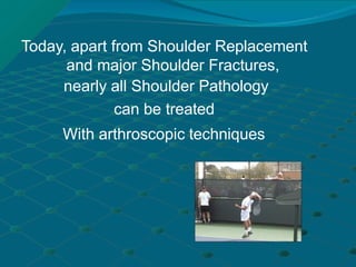 Shoulder Arthroscopy positioning and preparation | PPTX