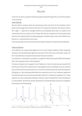 How to Build an ECG | PDF | Heart and Cardiovascular Diseases | Diseases and Conditions
