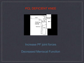 PCL Posterior Cruciate Ligament Knee Injury: Is it Benign I Dr.RAJAT ...