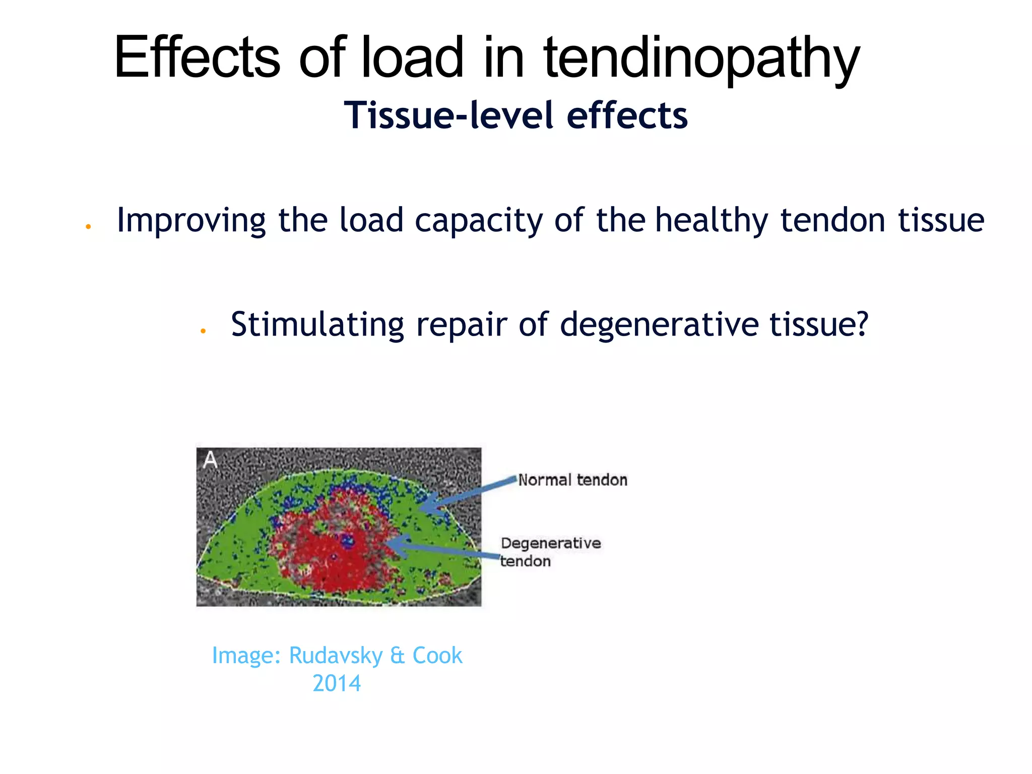 Treatment options of Tendinopathy in Athletes: Tendon Overload I Dr ...