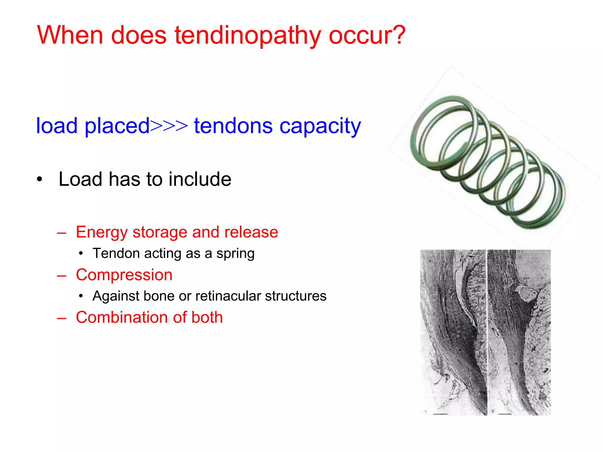 Treatment options of Tendinopathy in Athletes: Tendon Overload I Dr ...