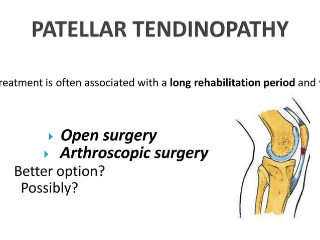 Treatment options of Tendinopathy in Athletes: Tendon Overload I Dr ...