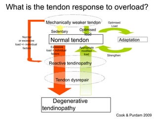 Treatment options of Tendinopathy in Athletes: Tendon Overload I Dr ...
