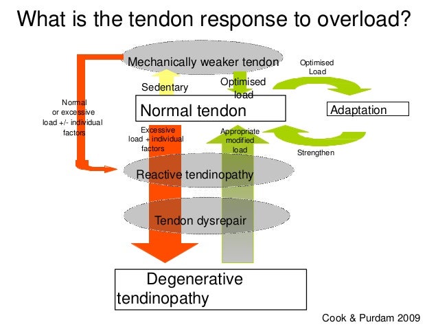 Treatment options of Tendinopathy in Athletes: Tendon Overload