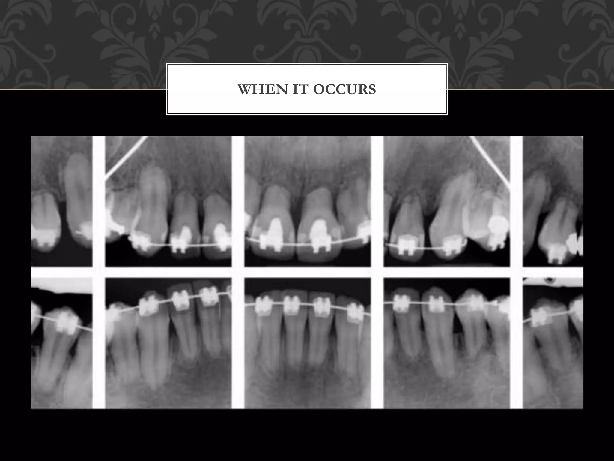 Iatrogenic effect part 2 | PPTX