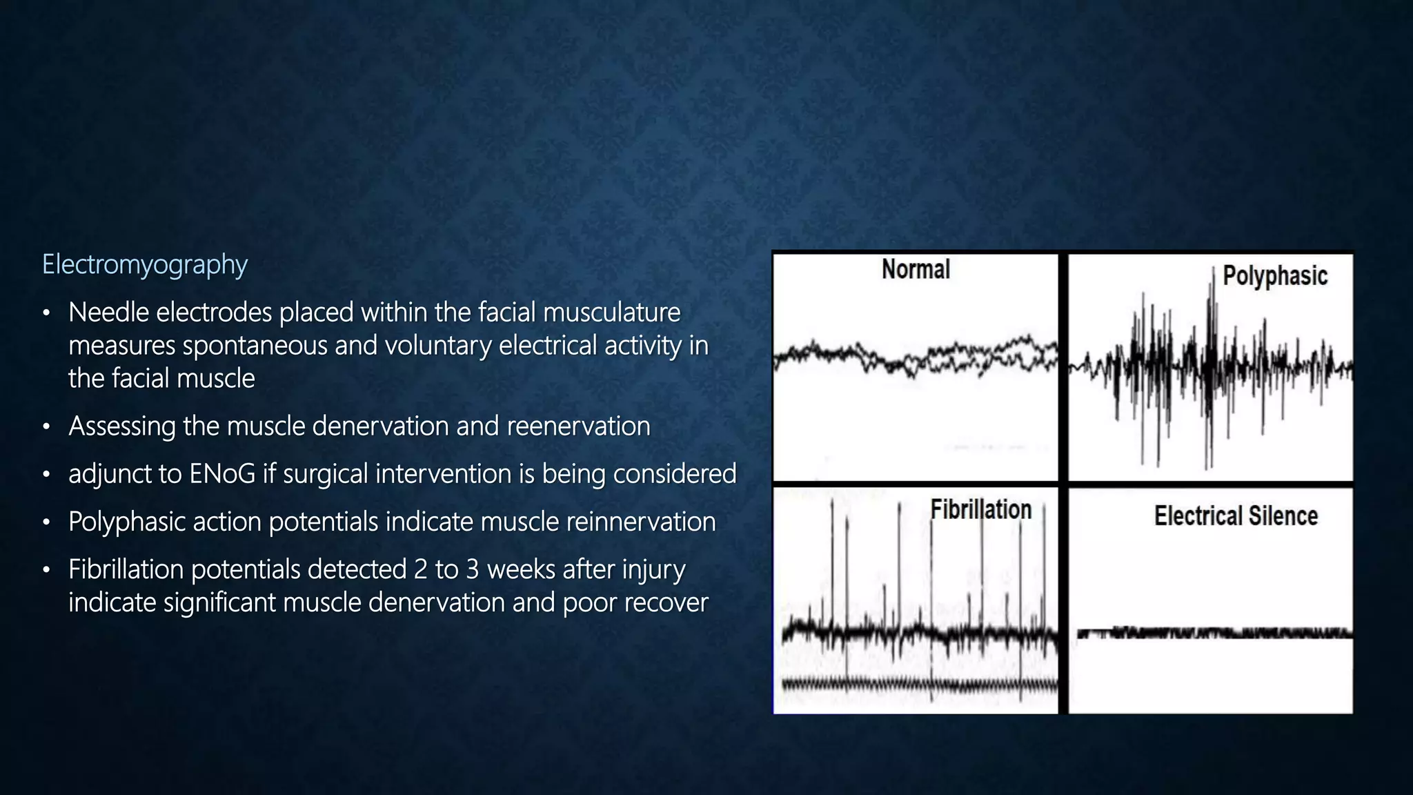 Iatrogenic facial nerve injury | PPTX