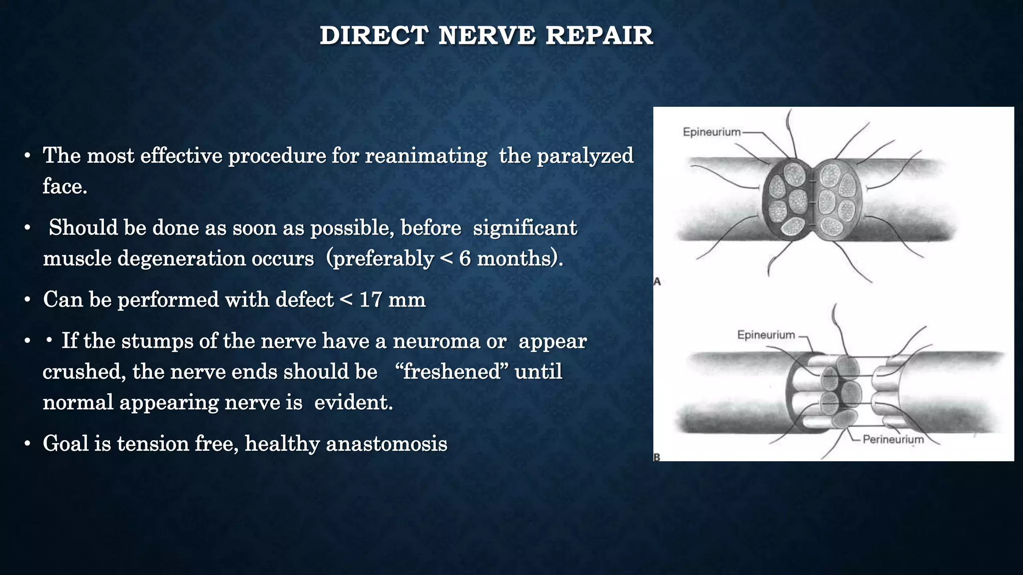 Iatrogenic facial nerve injury | PPTX
