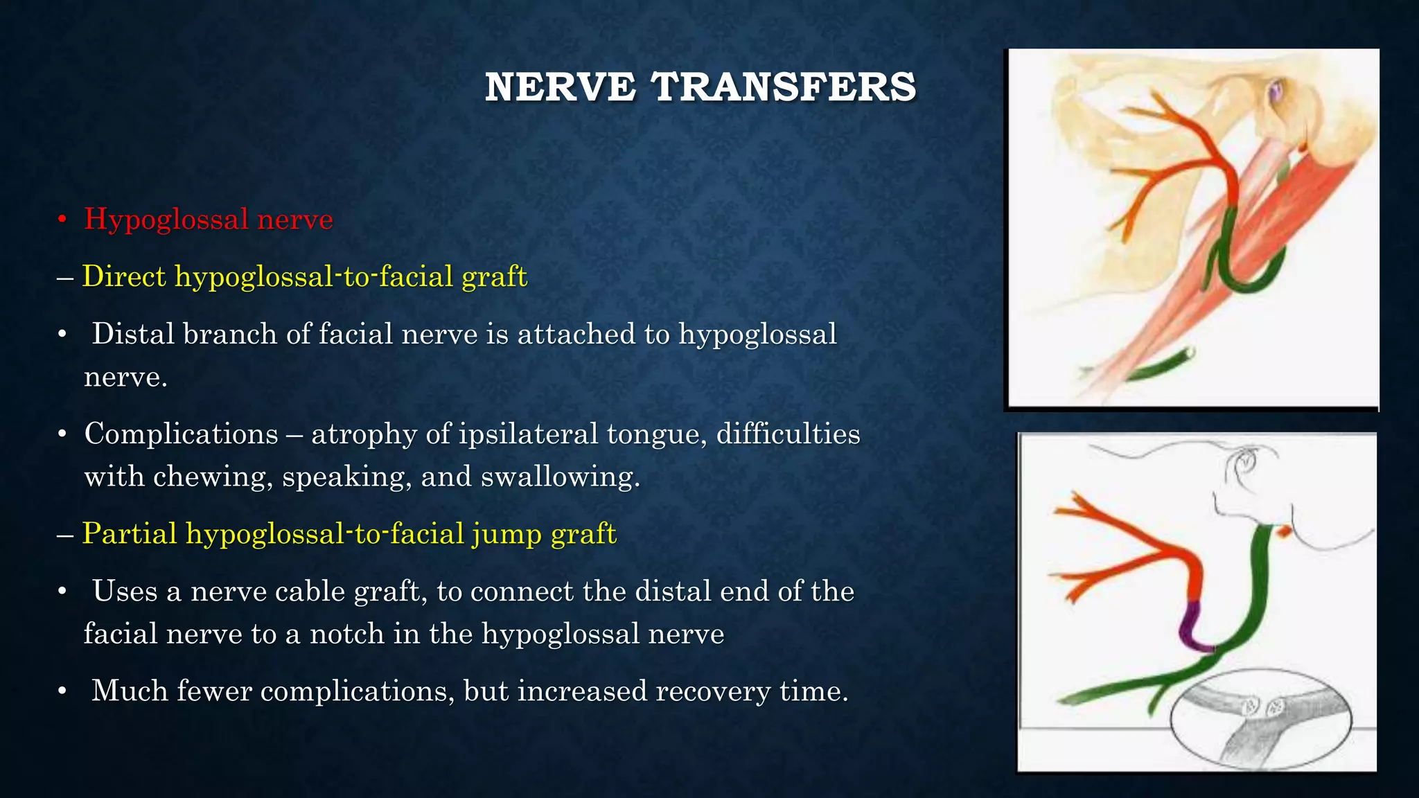Iatrogenic facial nerve injury | PPTX