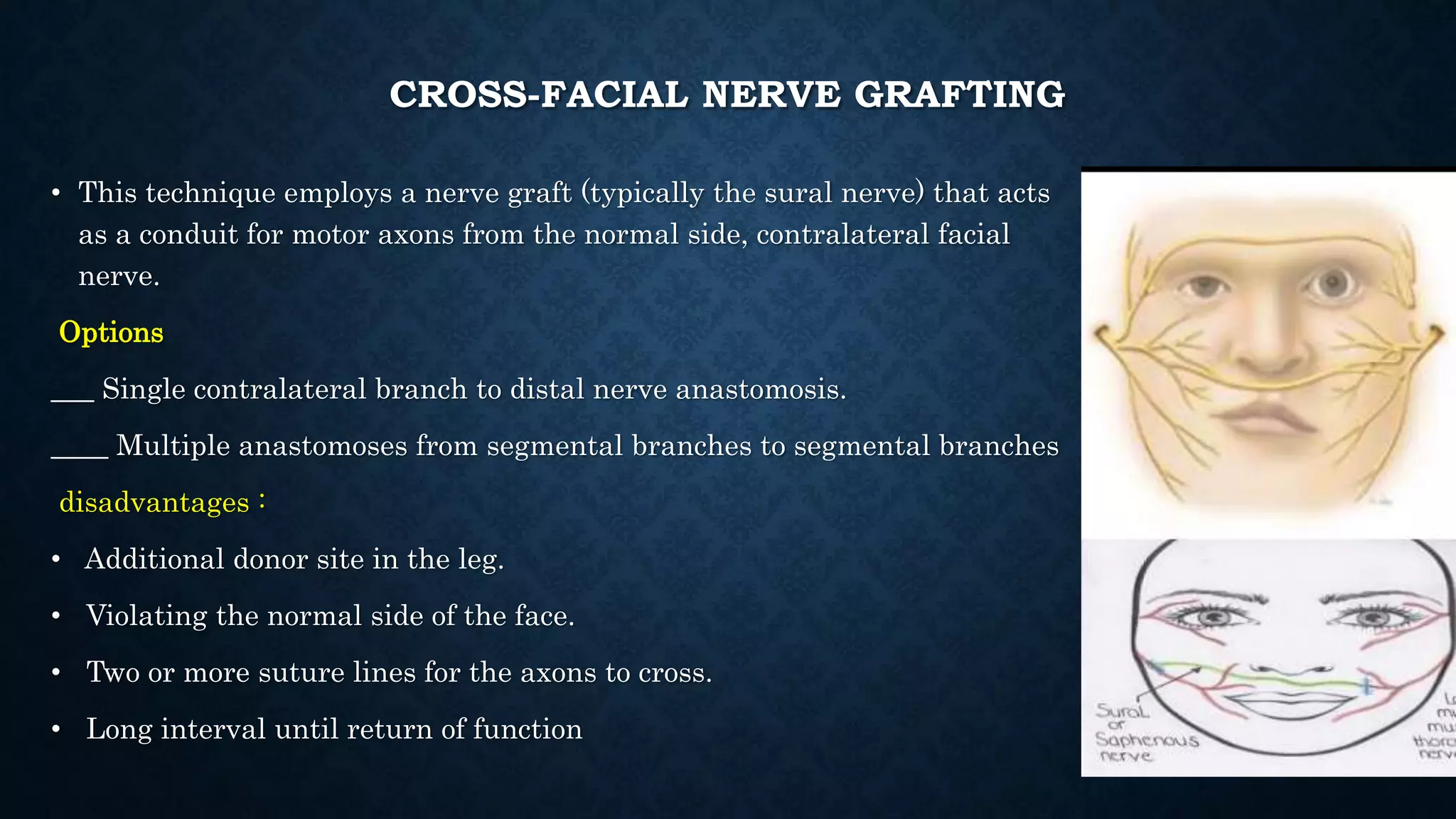 Iatrogenic facial nerve injury | PPTX