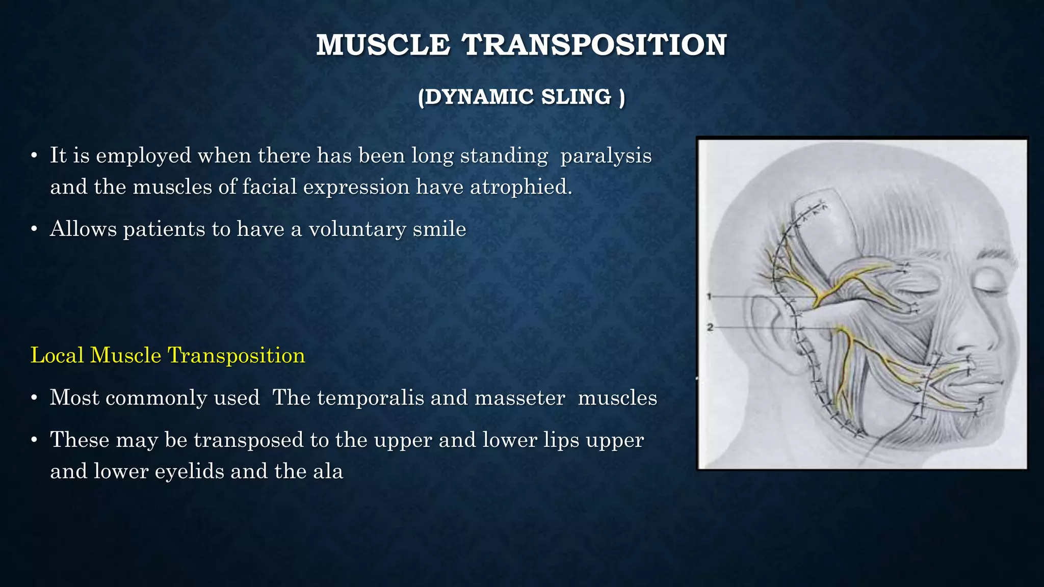 Iatrogenic facial nerve injury | PPTX