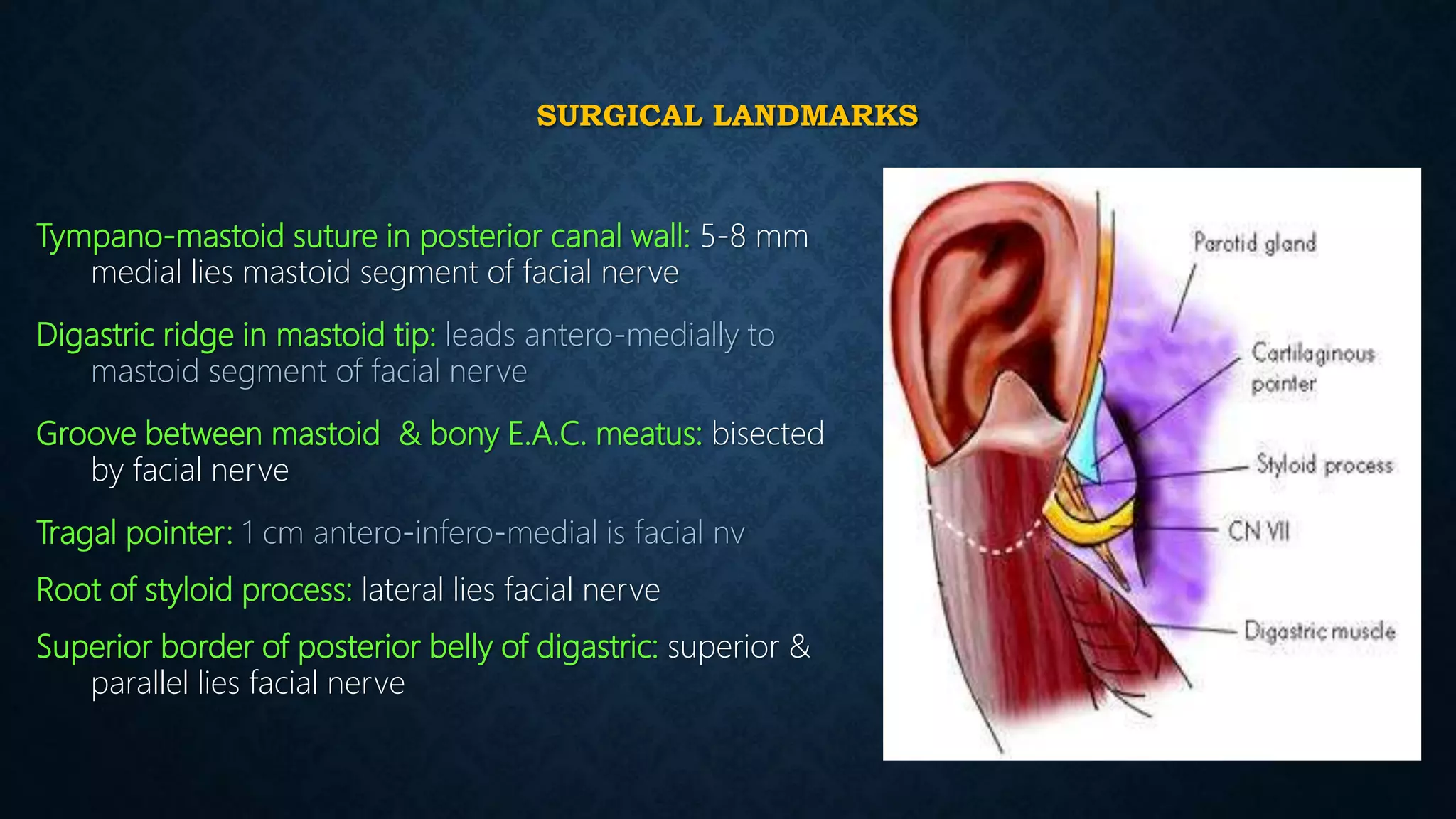 Iatrogenic facial nerve injury | PPTX