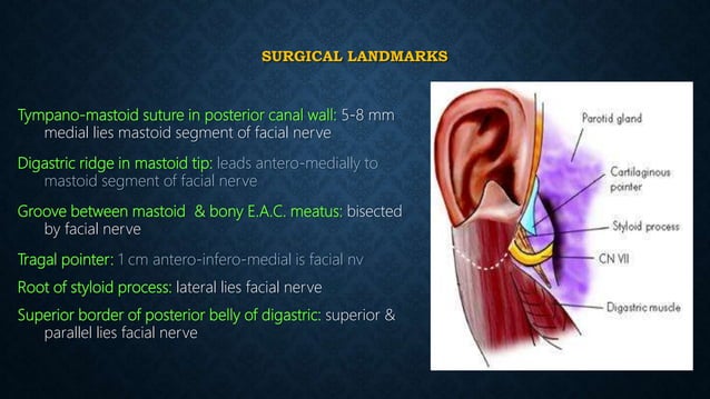 Iatrogenic facial nerve injury | PPTX | Ear, Nose and Throat Conditions ...