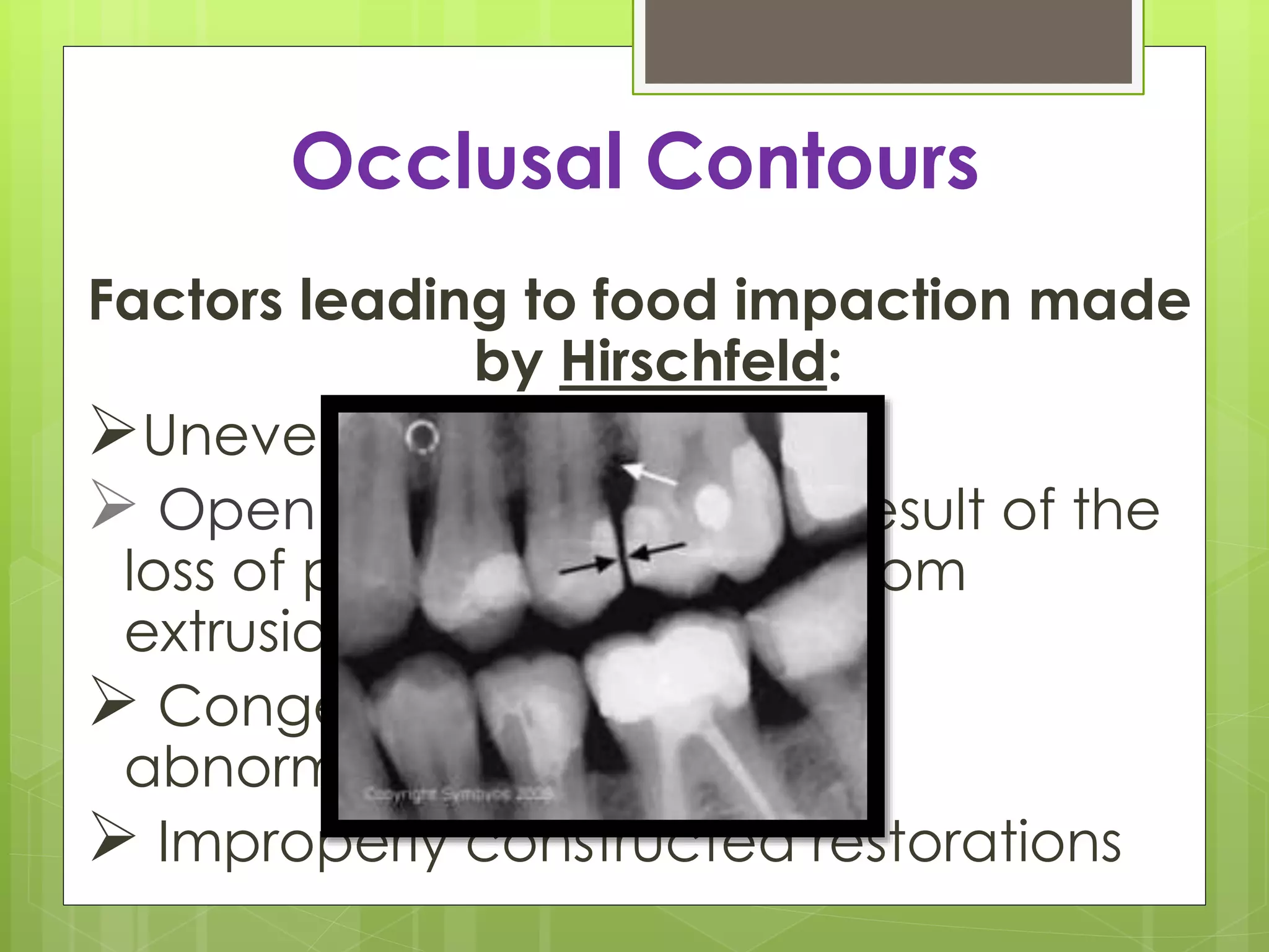 Iatrogenic factors in periodontal disease | PPTX
