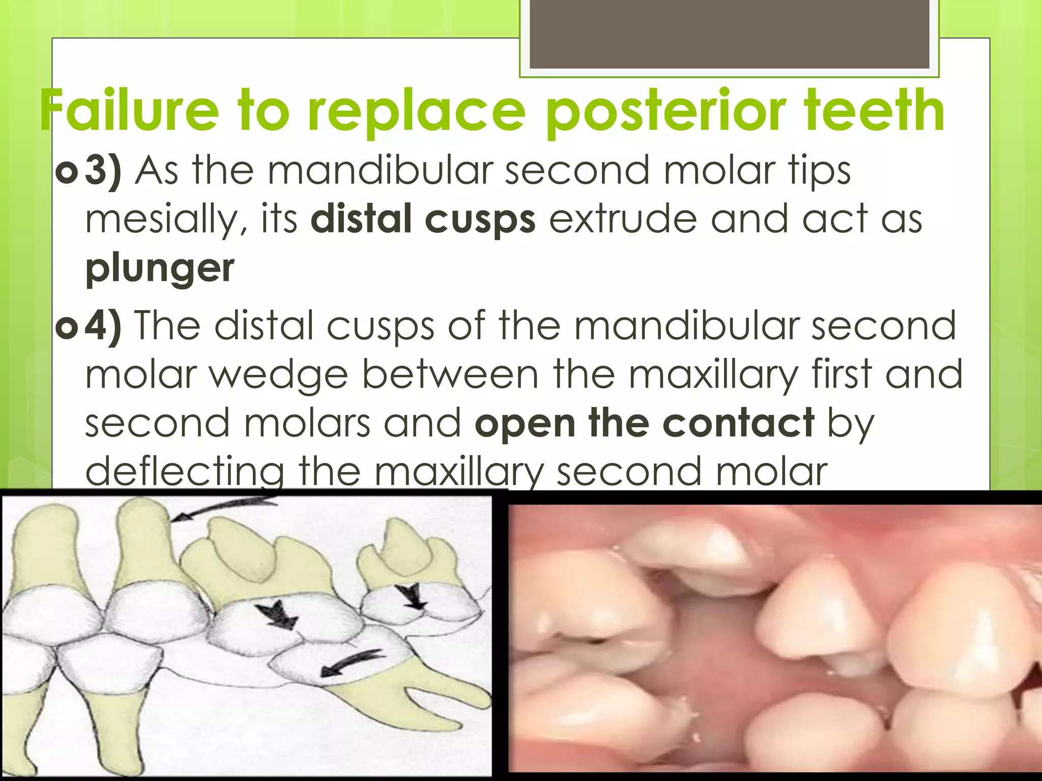 Iatrogenic factors in periodontal disease | PPTX